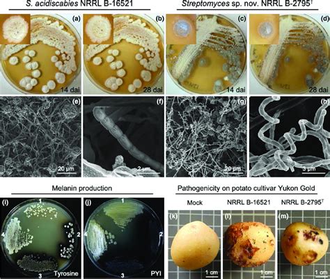 Morphological And Pathogenetic Characteristics Of Streptomyces Strains
