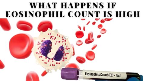 High Low Absolute Eosinophil Count Functions