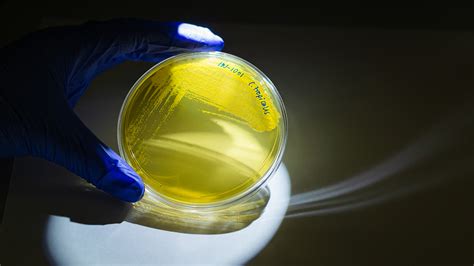 A New Approach To Spotting Tumors Look For Their Microbes The New