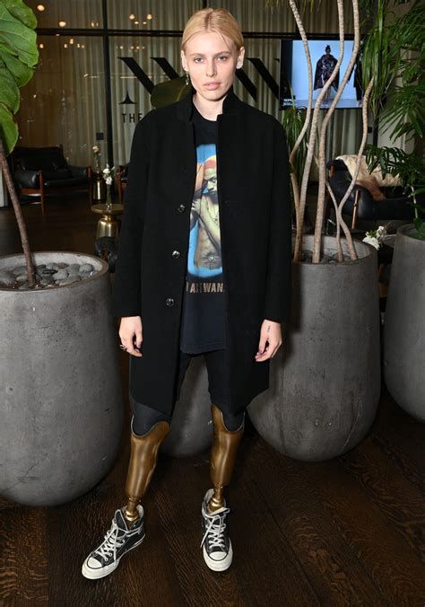 Lauren Wasser Fashions Girl With The Golden Legs” Is Making History