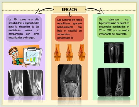 Resonancia MagnÉtica En Fracturas PatolÓgicas EspontÁneas De Las