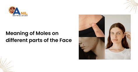 Moles On Neck Meaning