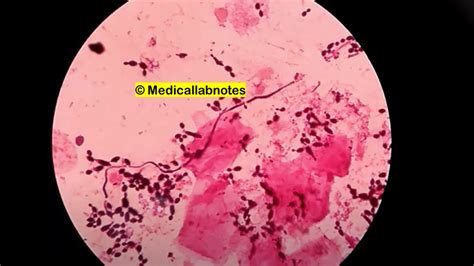 Candida Introduction Morphology Pathogenicity Lab Diagnosis