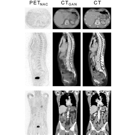 Representative Data Set Showing Non Attenuation Corrected 18 Download Scientific Diagram