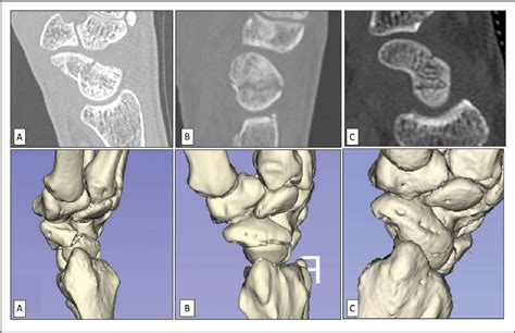 Figure 1 From The Influence Of Fracture Location And Comminution On