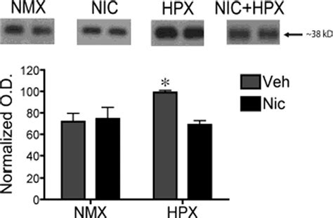 Prenatal Hypoxia Significantly Increased Synaptophysin Protein Levels Download Scientific