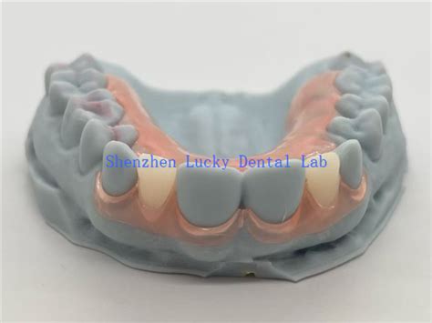 China Cheap Dental Tcs Flexible Partial Dentures Manufacturers Suppliers Factory Lucky
