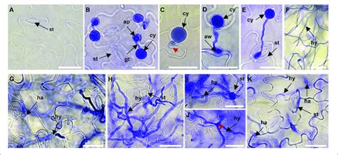 Microscopic Analysis Of The Progression Of Phytophthora Capsici
