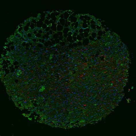 Colocalization Analysis Image Analysis Image Sc Forum