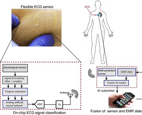 A Diagrammatic Representation Of The Proposed Model With Components