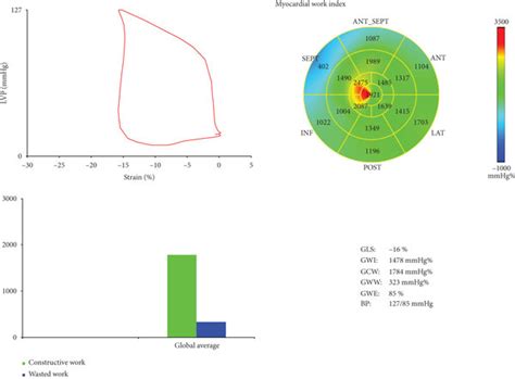 Pressure Strain Loop And 17 Segments Of The Left Ventricular Myocardium Download Scientific