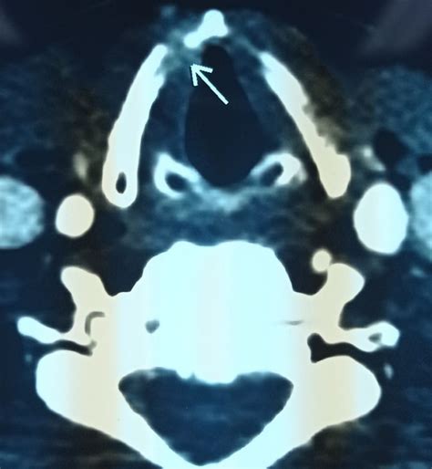 Dr Jay Patel On Linkedin Esfagm9d