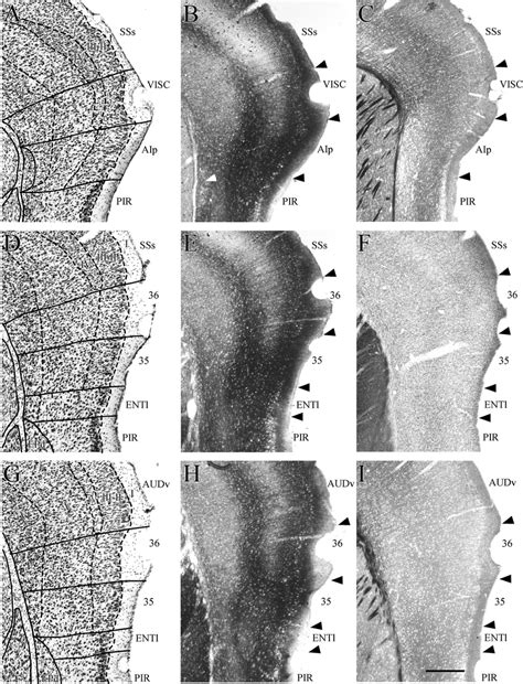 Coronal Sections Showing Rostral Perirhinal Cortex Per And Bordering