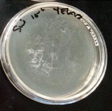 Plate 1 Of 100 Plant Extract Concentration Download Scientific Diagram