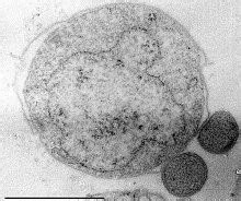 Ignicoccus Wikipedia