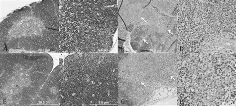 Mareks Disease Virus Induced Transient Cecal Tonsil Atrophy