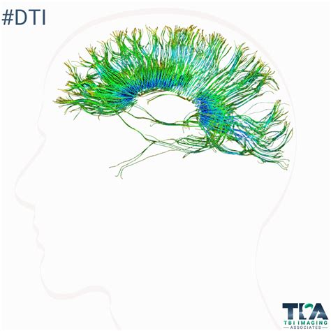 Diffusion Tensor Imaging Is A Tbi Imaging Associates
