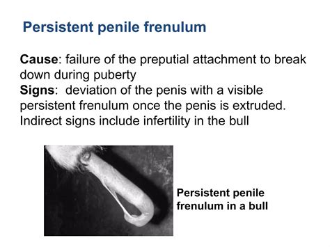 Surgical Affection Of Penis And Prepuce Pptx