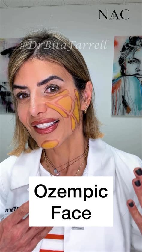 Ozempic Injection Site Reactions Symptoms