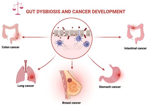 Cancer Development Diagram