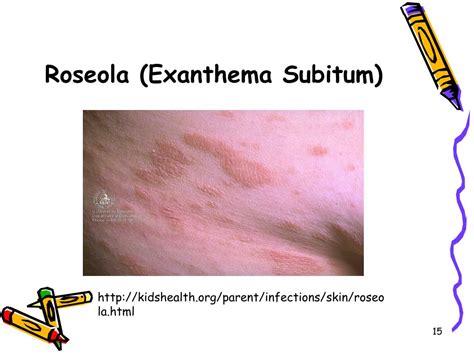 Ppt Lecture 11 Unit 3 4 Powerpoint Presentation Free Download Id