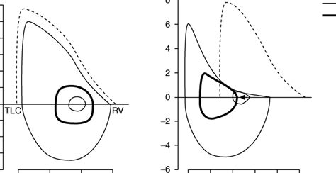 In A Healthy Volunteer And A Typical Patient With Copd Tidal