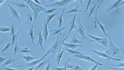 Human Fibroblasts Chemical Reprogramming Ameliorates Cellular
