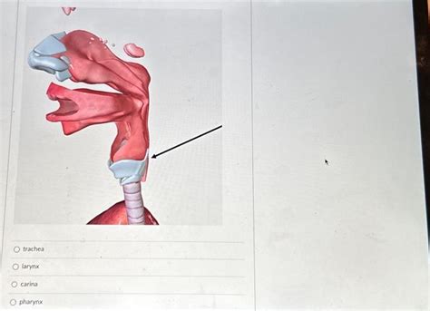 Solved Name The Structure Primary Bronchus Secondary