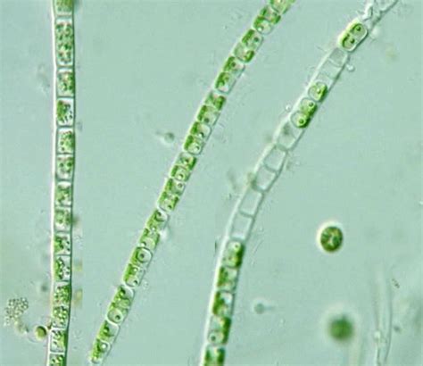 Protist Images Microspora