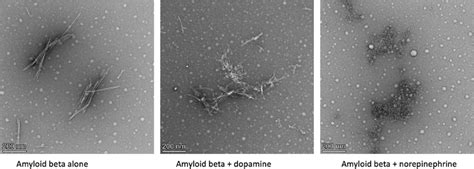 Transmission Electron Microscopy Amyloid Beta Alone And In The Download Scientific Diagram
