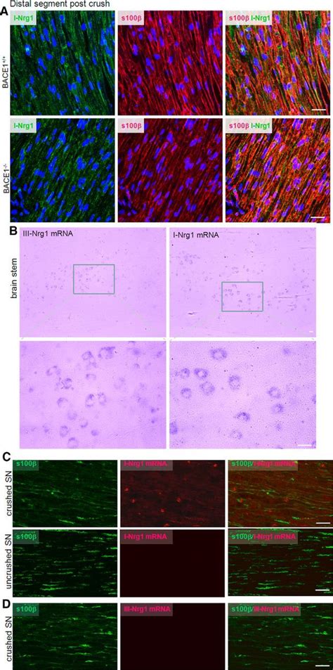 Axonal And Schwann Cell Bace1 Is Equally Required For Remyelination Of