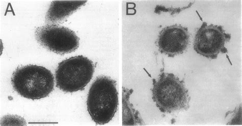 Comparison Of The Cell Surface Ultrastructure Of Cellobiose Grown