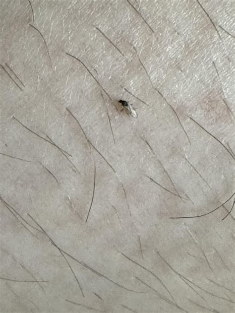 What Is This Biting Bug Rwhatsthisbug