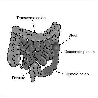 Descending Colon Location Function Disorders And Pictures