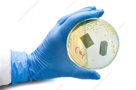 Cultured Urinary Bacteria Stock Image C023 2943 Science Photo Library