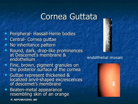 Edandcornea Lecture Fatima