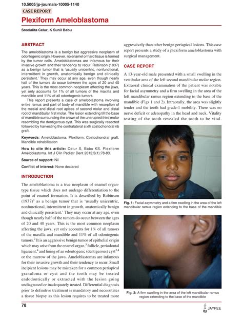 Pdf Plexiform Ameloblastoma