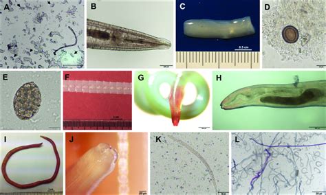 Ejemplos De Helmintos Intestinales Identificados Mediante Diferentes