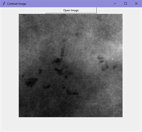 Python Image Processing On Grayscale Medical Image Stack Overflow