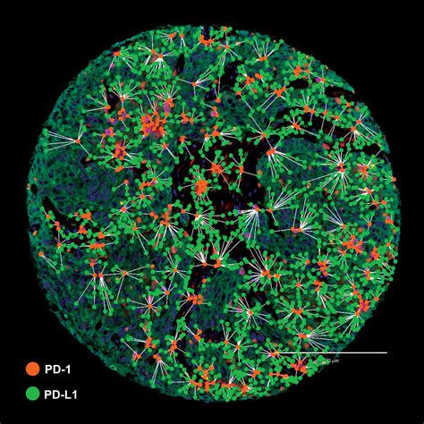 High Plex Spatial Signatures Can Predict Responses To Immunotherapies
