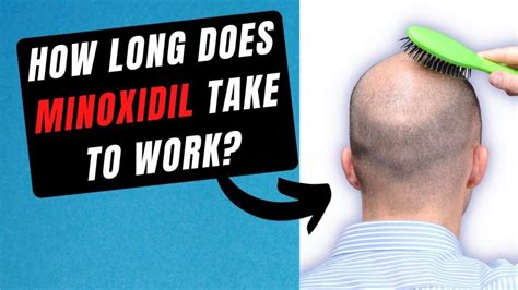 How Long Does Minoxidil Take Should You Use It For Hair Growth