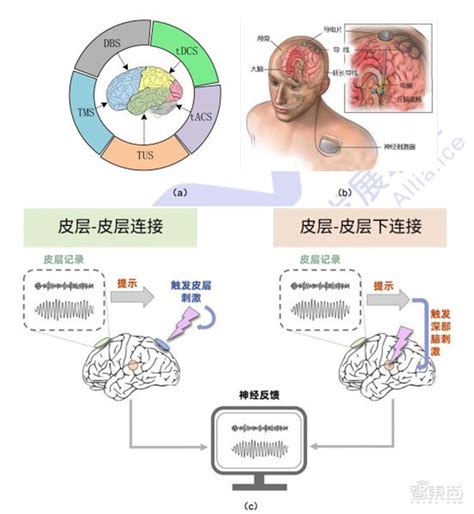 脑机接口破圈医疗！对五种疾病或有奇效 难怪马斯克吹爆凤凰网科技凤凰网