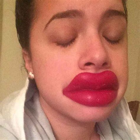 20 Reasons Why You Shouldnt Try The Kylie Jenner Lip Challenge Look