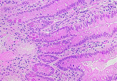 Duodenum Wall Ts For Paneth Cells Photograph By M I Walker Fine
