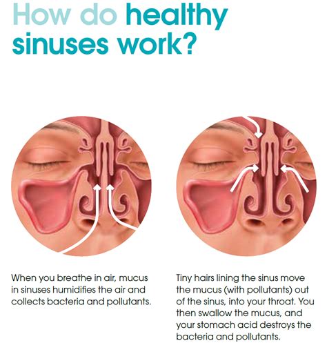 Sinus Problems Dr James Go