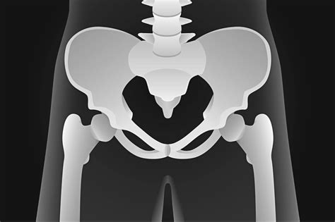 Do I Have Pelvic Floor Dysfunction How To Screen For This