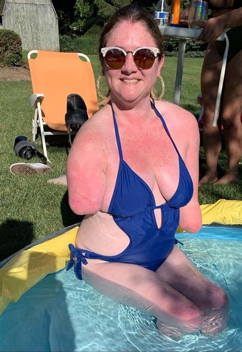 Sexy Quad Amputee Enjoying Her Pool Great Arm Stump Ive Got More Of