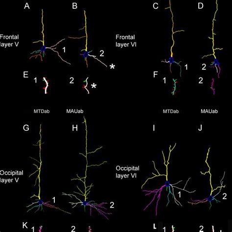 Neurolucida Reconstruction Of Representative Pyramidal Neurons In