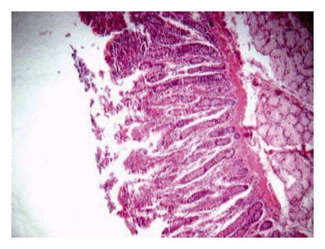 Histopathological Observation Of Jejunum And Intestinal Villus Height
