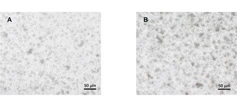 In Vitro Differentiation Of Naive Cd4 T Cells Into Pathogenic Th17